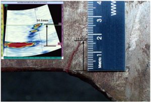 Nozzle-Toe-Crack-1 - AUT Solutions